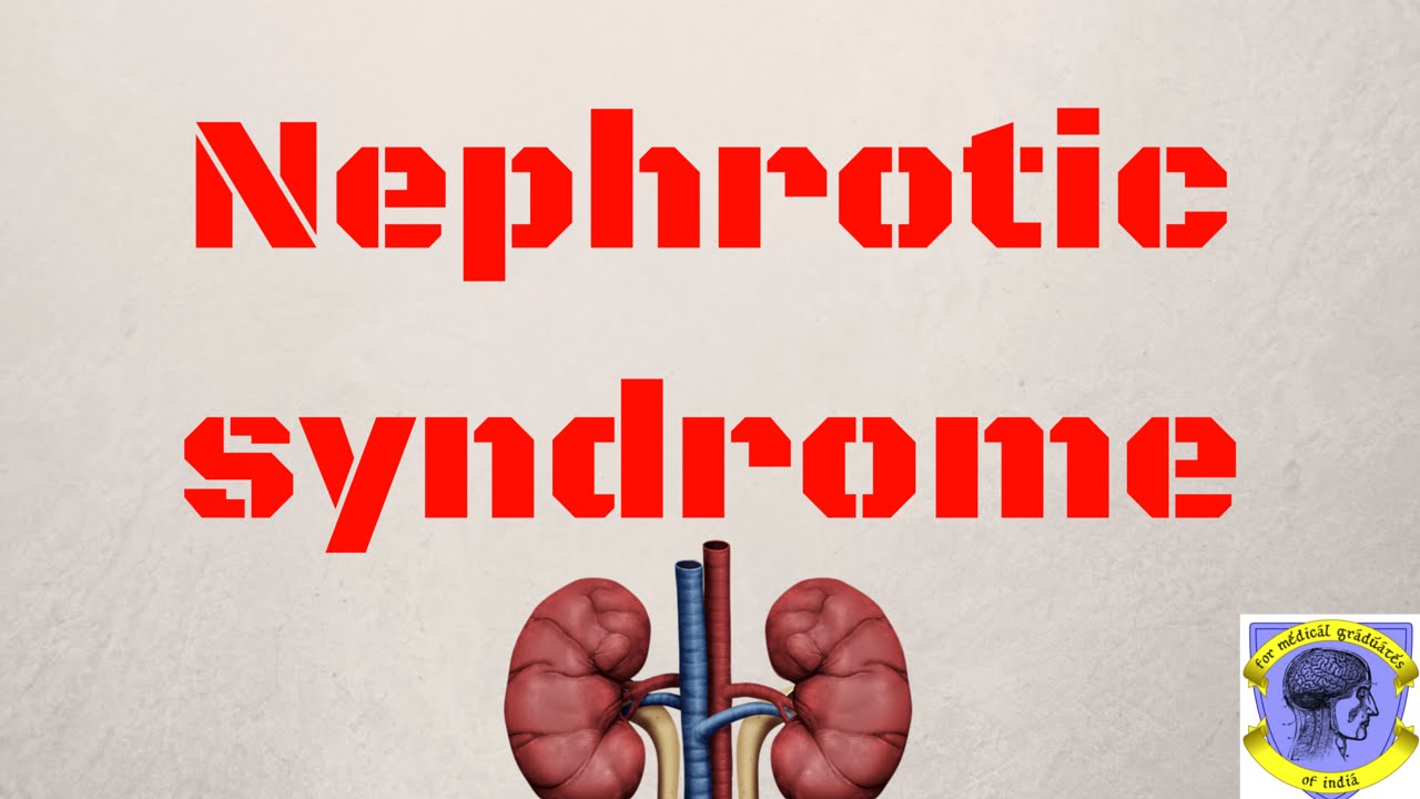 Νεφρωσικό Σύνδρομο - Ζαγοριανάκος Αντώνιος MD - Νεφρολόγος